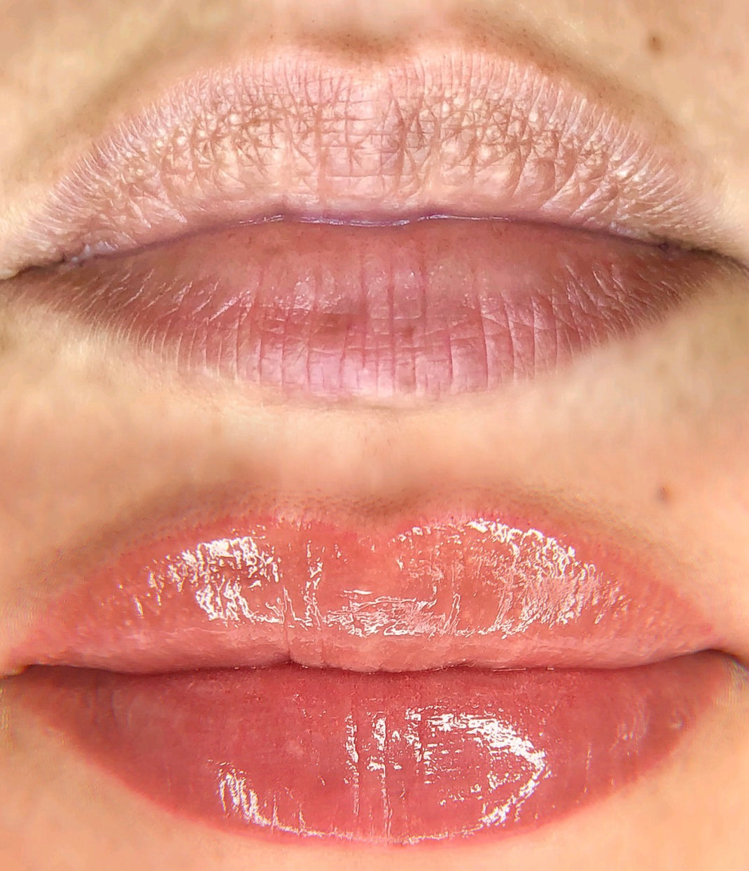 Lip Neutralization – Gabi Brows